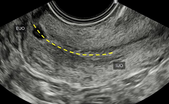 Ultrasound Assessment of Pelvic Anatomy | Article | GLOWM